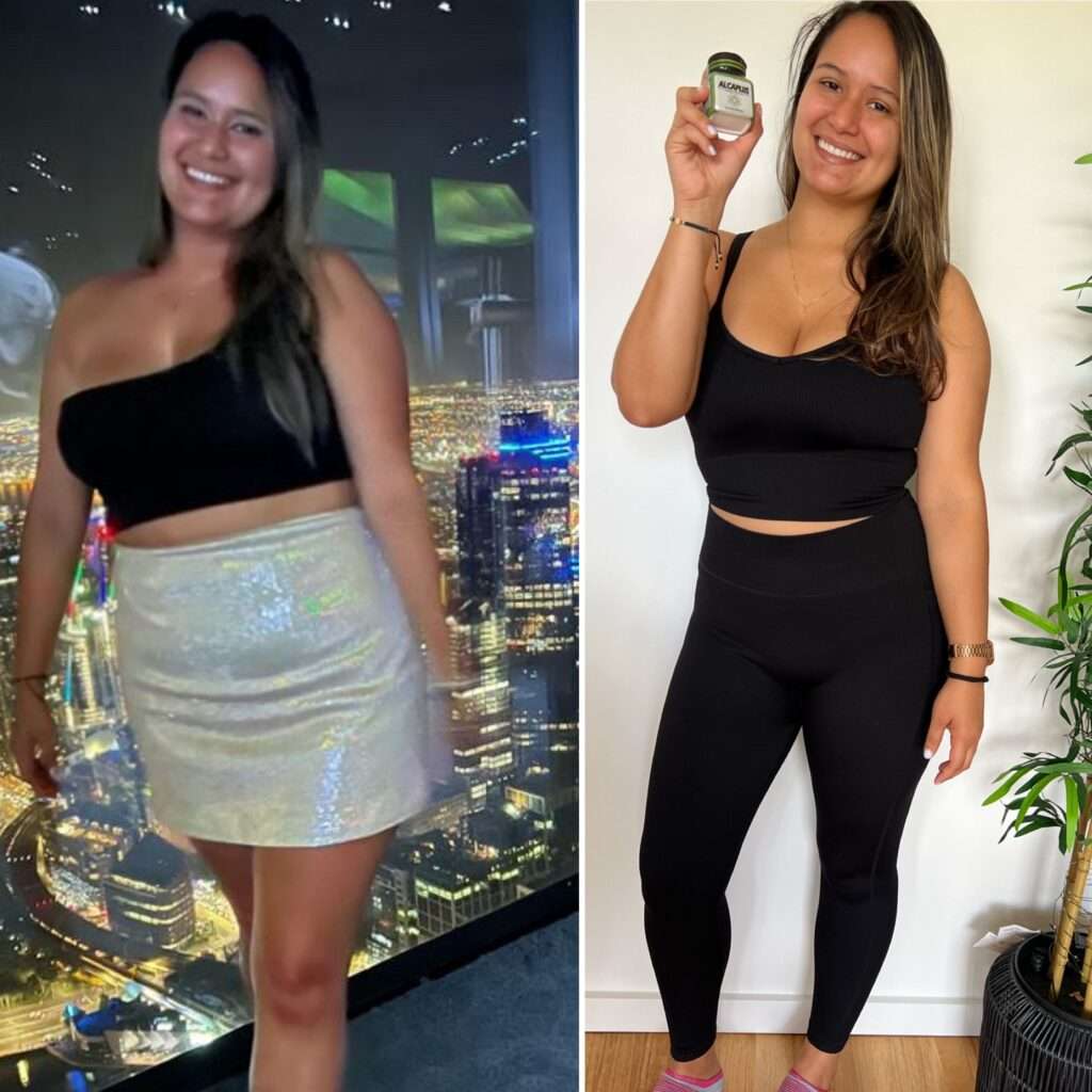 KIT ALCAPLUS X 3 FRASCOS - Alcaplus